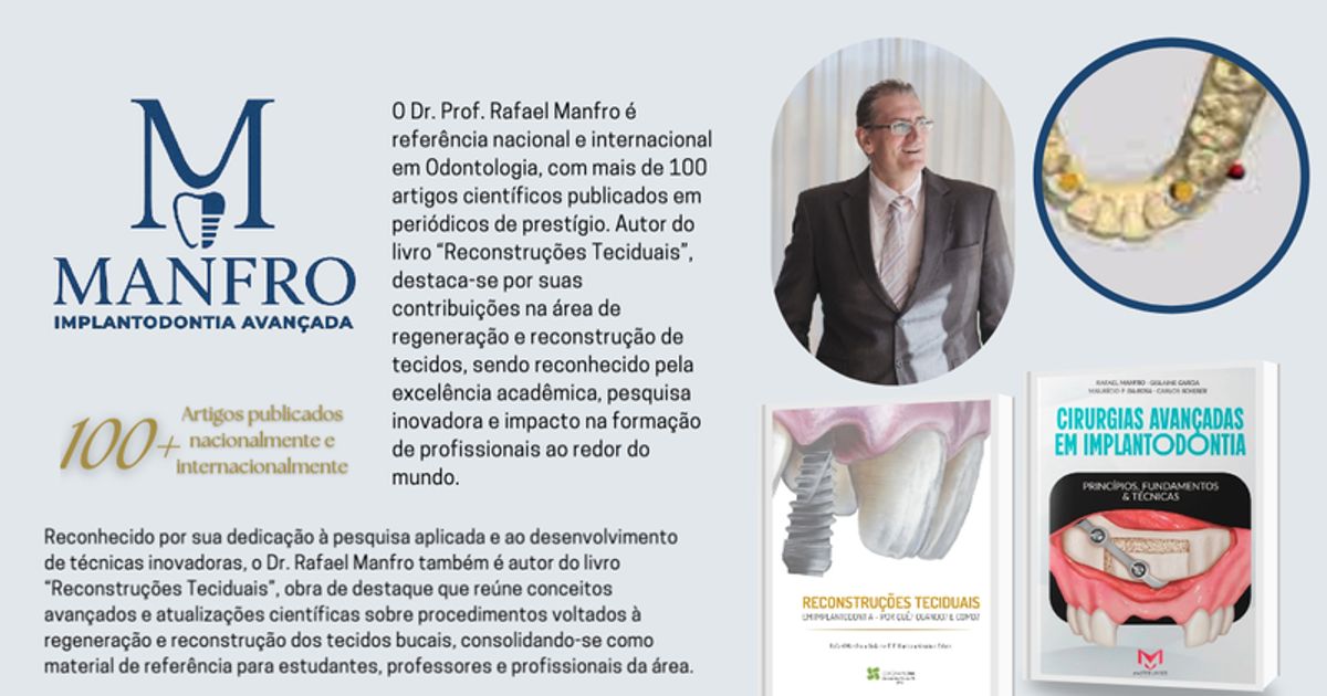 Manfro Implantodontia Avançada